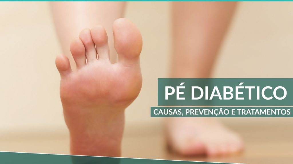 5 DICAS PARA CUIDAR DO PÉ DIABÉTICO - Farmadia - Farmácia Especializada ...